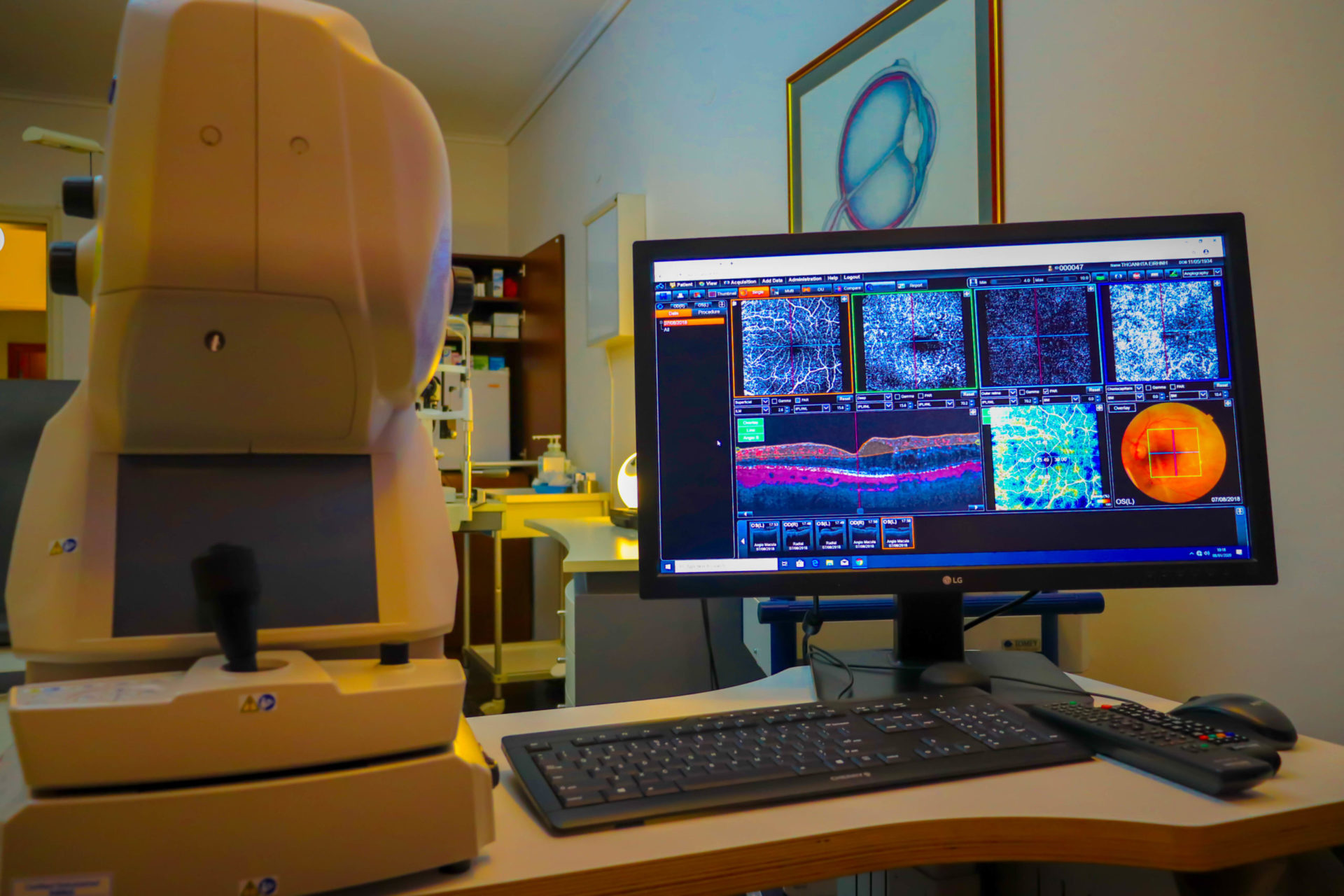 ΣΙΟΥΛΗΣ ΧΡΗΣΤΟΣ MD, PhD | Χειρουργός Οφθαλμίατρος Θεσσαλονίκη